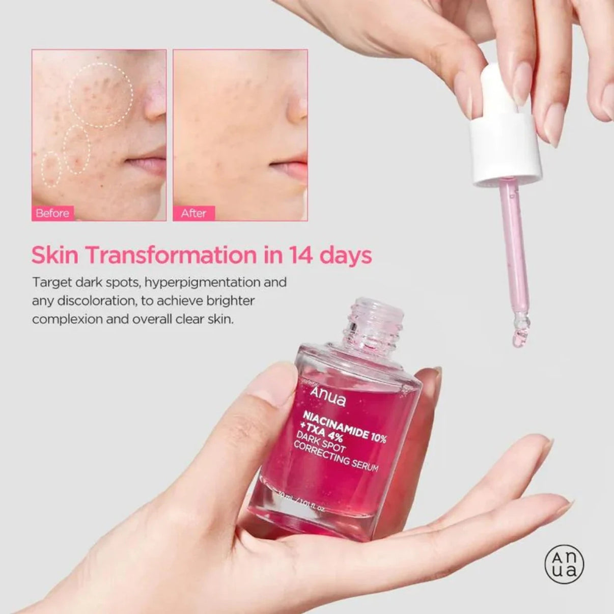 Anua Niacinamide 10% + Txa 4% Serum 30ml – W Cosmetics